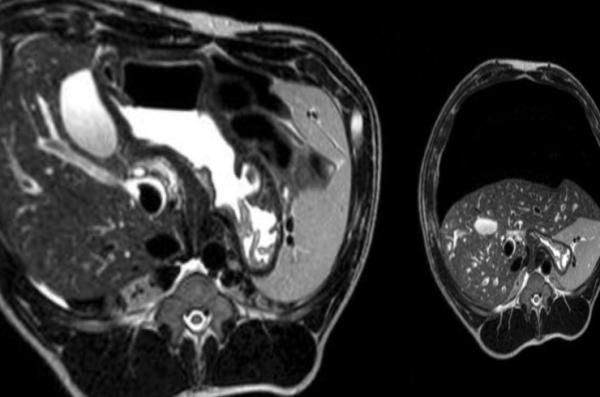MRI Data Analysis and Interpretation - Endpoint Preclinical