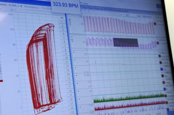 Ventricular PV Loops - Endpoint Preclinical